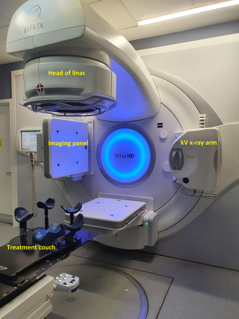 How has radiotherapy treatment changed with new technological advances ...